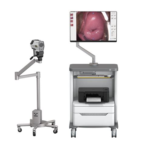 Advanced Digital Colposcopy Solutions High Resolution Imaging