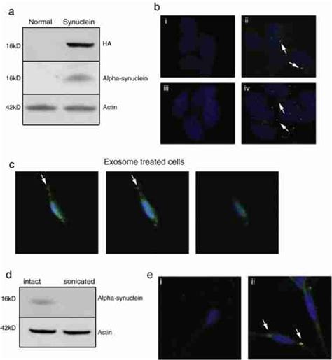 Analysis Of The Inter Cellular Transfer Of Alpha Synuclein By Exosomes Download Scientific