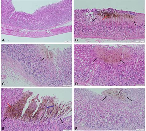 A The Control Group Show Normal Gastric Histopathology Hande ×100 B Download Scientific
