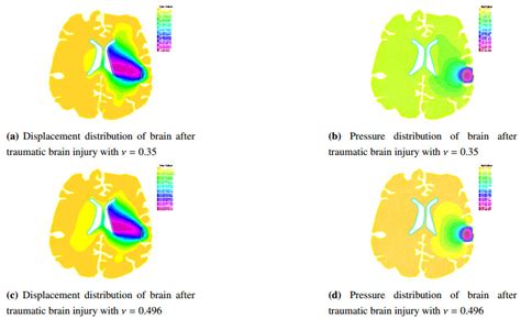 Convergence And Parameter Robust Analysis Of Several Locking Free Algorithms For A Linear