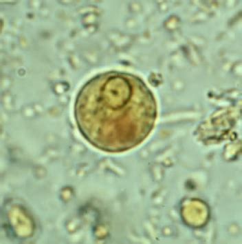 Laboratory Quiz One Amoeba Morphology Flashcards Quizlet