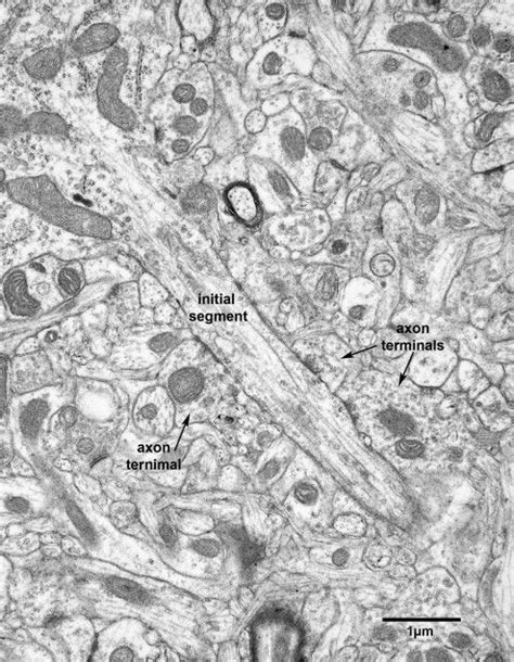 Axon Initial Segment In Animal Cell