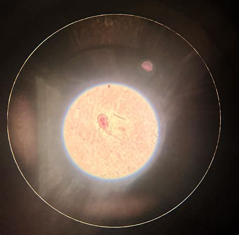 My Favorite Parasite Giardia Intestinalis R Microbiology