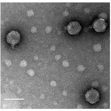 Transmission Electron Micrograph Of Jc1 High Titer Cscl Gradient Download Scientific Diagram