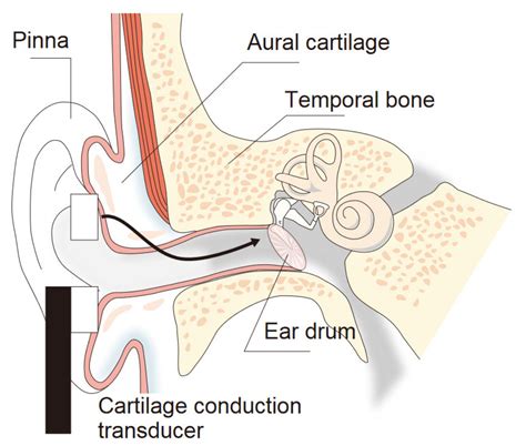 Scaphoid Fossa Ear