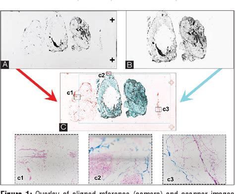 Figure 1 From Measuring Digital Pathology Throughput And Tissue Dropouts Semantic Scholar