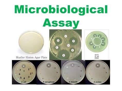 Microbiological Assay Pptx