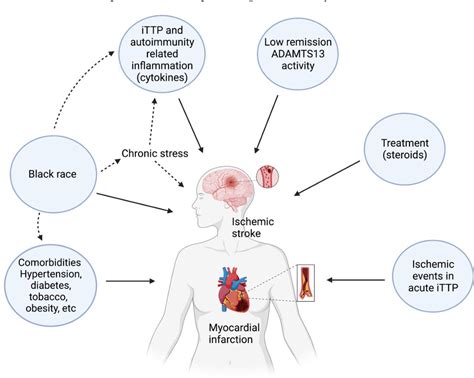 Figure 1 From Cardiovascular Disease And Stroke In Immune Ttp