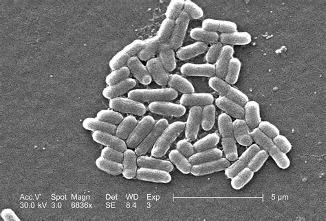 40 Escherichia Coli Gambar Gratis