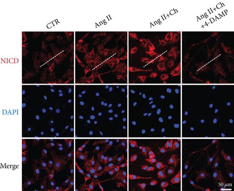 Choline Improved Notch1 Intracellular Domain Nicd Expression And