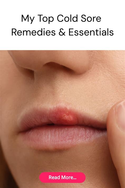 Best 13 The Cold Sore Emergency Kit 11 Products To Keep On Hand At All