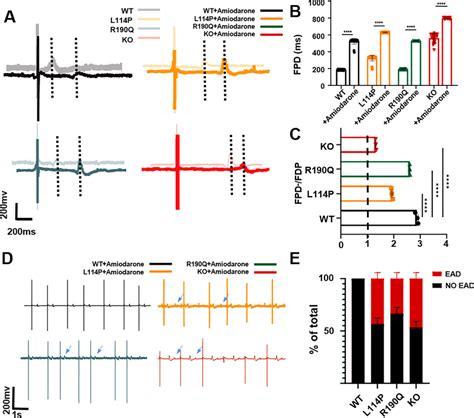 Four Cms In Response To Amiodarone A B Representative Fpd And Download Scientific Diagram