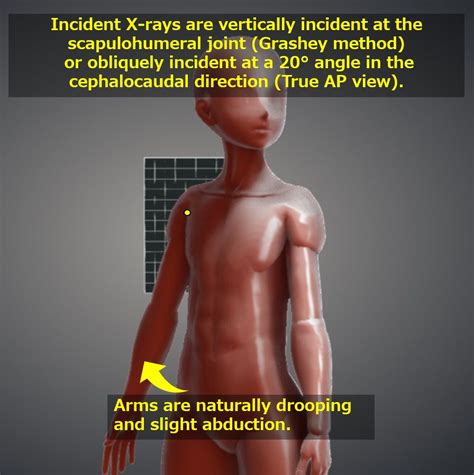 Shoulder Joint Oblique View Grashey Method True Ap View｜tools For