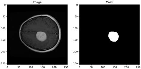 A Unified Pipeline For Simultaneous Brain Tumor Classification And