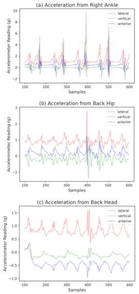 Machine Learning Approach For Automated Detection Of Irregular Walking Surfaces For Walkability