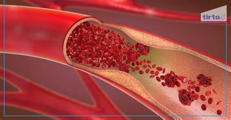 Mengenal Sel Darah Fungsinya Eritrosit Leukosit Serta Trombosit