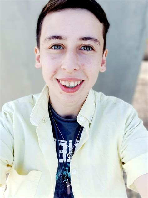Finally Removed My Braces R Trans