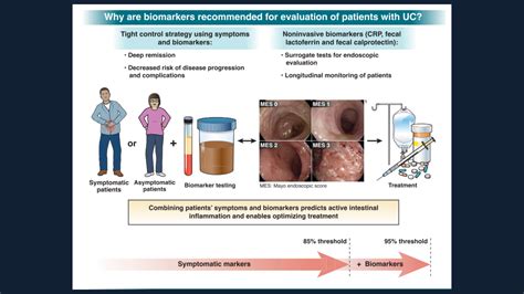 New Aga Guidelines Back Biomarkers For Ulcerative Colitis American Gastroenterological Association