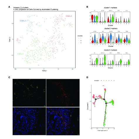 Imaging And Histology Of Matched Ptc Cases Ca Primary Ptc Samples