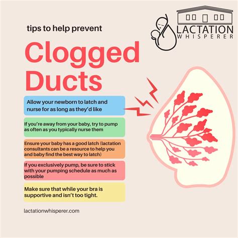 Lactation What Are Clogged Milk Ducts Clogged Milk Ducts Can Be