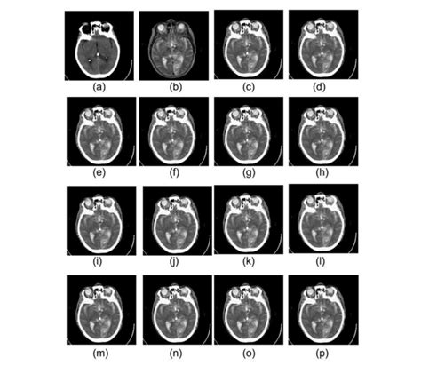 A Input Ct Image B Input Mri Image Fused Image Obtained With C