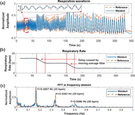 Figure 2 From Real Time Contactless Respiration Monitoring From A Radar Sensor Using Image
