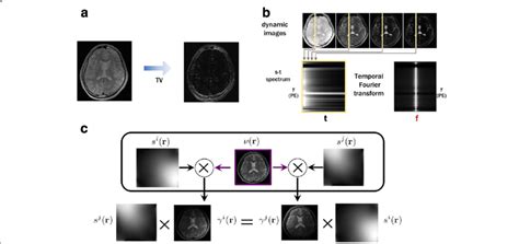 Various Types Of Sparsity In Mri A Sparsity From Spatial Domain Download Scientific Diagram