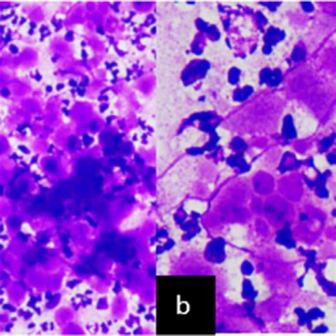 What Are The Histological Specimen At Kevin Marsh Blog