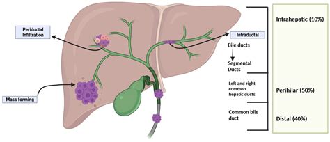 The Recent Trends Of Systemic Treatments And Locoregional Therapies For Cholangiocarcinoma