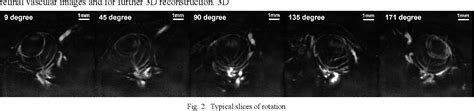Figure 2 From 3d Rotation Scan Of Rat Retinal Vessels Using 30mhz Ultrahigh Frequency Ultrafast