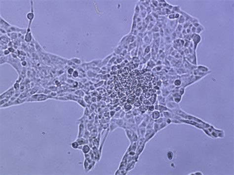 Questions With Answers In COLONY FORMING UNITS ASSAY Scientific Method