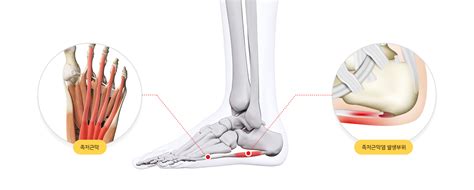 진료내용 서울척병원