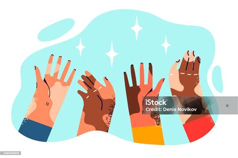 색소 침착 장애 후 백반증 질환에 걸린 피부색이 다른 사람들의 손 건선에 대한 스톡 벡터 아트 및 기타 이미지 건선