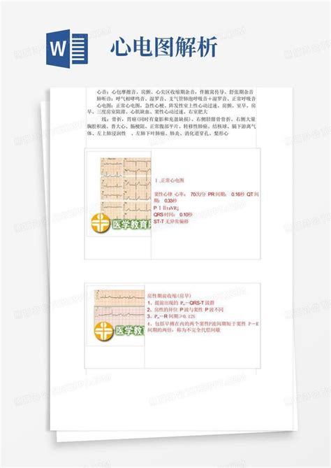 心电图解析word模板下载编号qkmembxo熊猫办公 心电图解析word模板下载编号qkmembxo熊猫办公