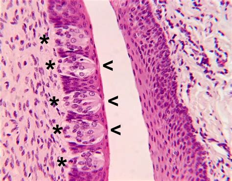 Tongue Histology Taste Buds