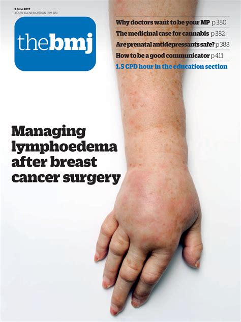 Bmj The Bmj