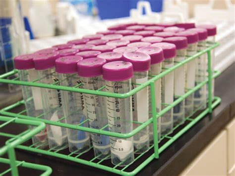 Epa Approved Test Methods At Mary Wilber Blog