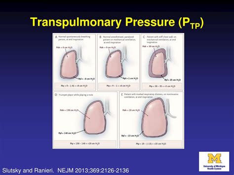 Ppt What Icu Evidence Applies To The Or Powerpoint Presentation