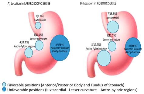 Gastroscopy Vs Eus At Indiana Seery Blog