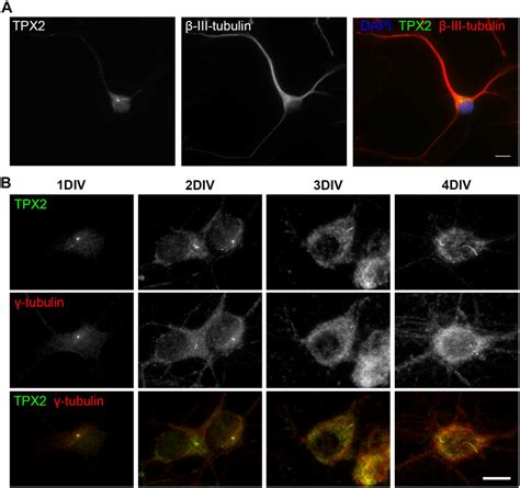 Tpx2 Localization In Dissociated Hippocampal Neurons A 5div