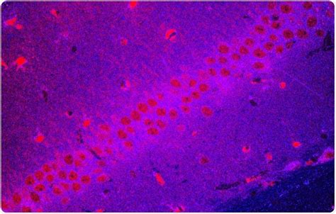 Cytoophidia Assembly Morphology And Function