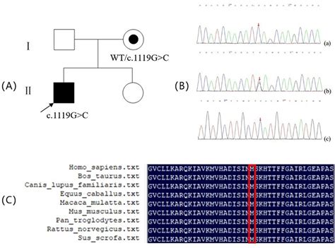 A Novel Ectodysplasin A Gene Mutation Ectodermal Dysplasia Ccid