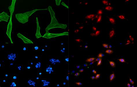 Optical Microscopy In Pathological Imaging