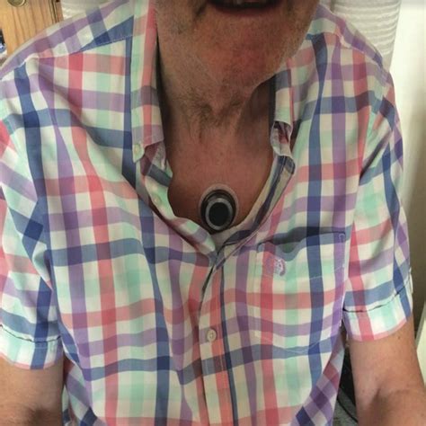 The Novel Vibrotactile Stimulation Device Cue1 Charco Neurotech Ltd Download Scientific