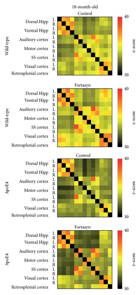 Resting State Functional Connectivity Fc Based On Total Correlation Download Scientific