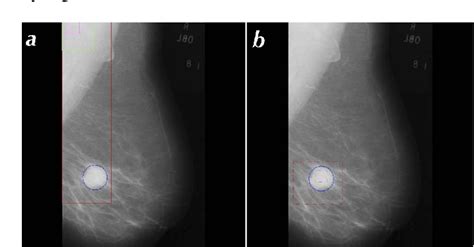 Figure 2 From High Performance Cuda Based Implementation For The 2d Version Of The Maximum