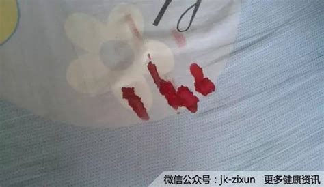 血迹怎么画用红笔 铅笔怎么画迹 怎么画迹在手上画 大山谷图库