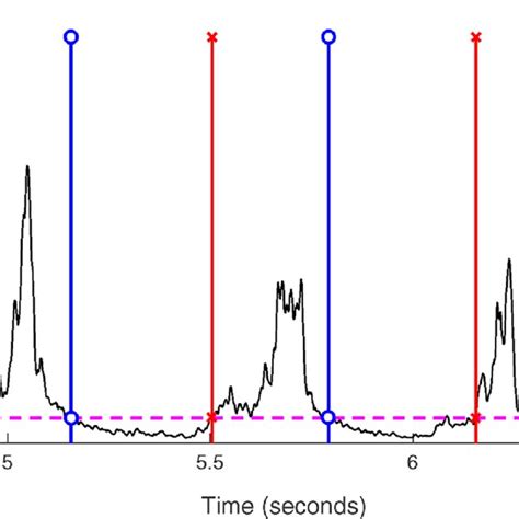 Signal Onset Detection And Segmentation Step A Threshold Defines The