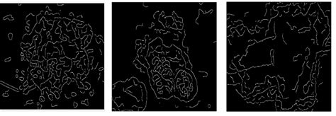 Edge Of The Skin Lesion Border Detected Download Scientific Diagram