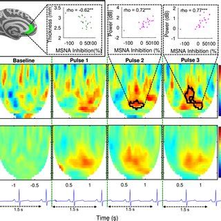 Structural And Functional Analysis Of The Anterior Cingulate Cortex Download Scientific